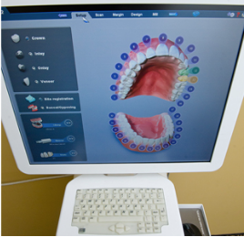Digital Capture In Dentistry