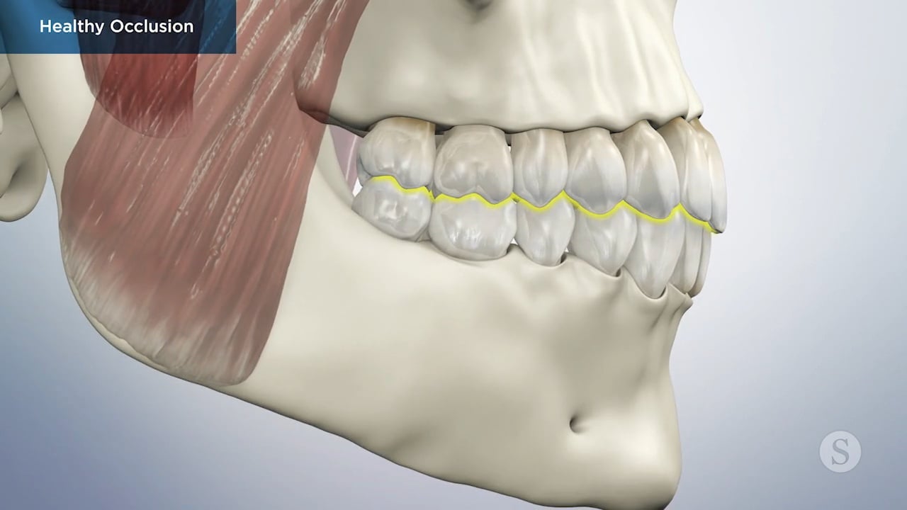 Occlusion: What It Is and Why It Matters